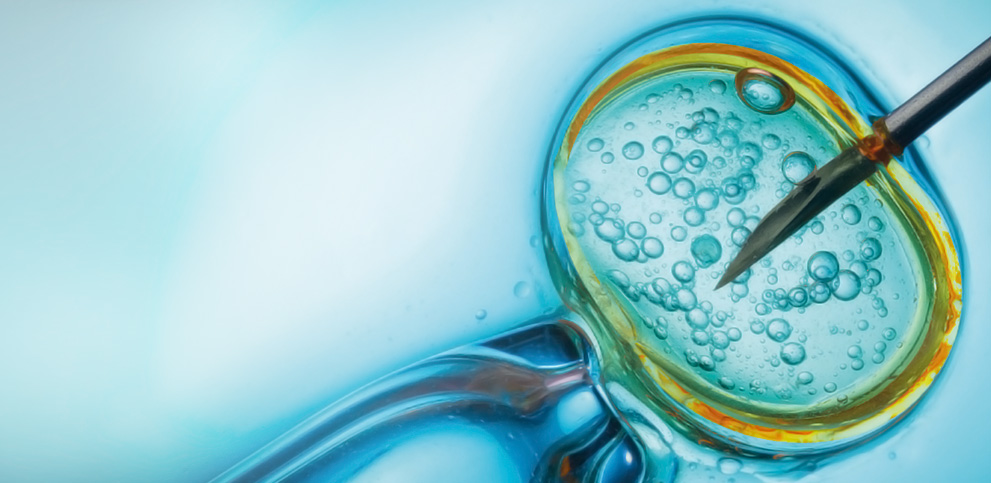 Εξωσωματική Γονιμοποίηση | IVF REA
