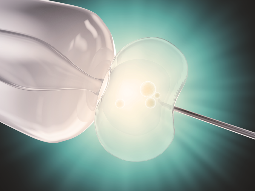Μικρογονιμοποίηση | IVF REA