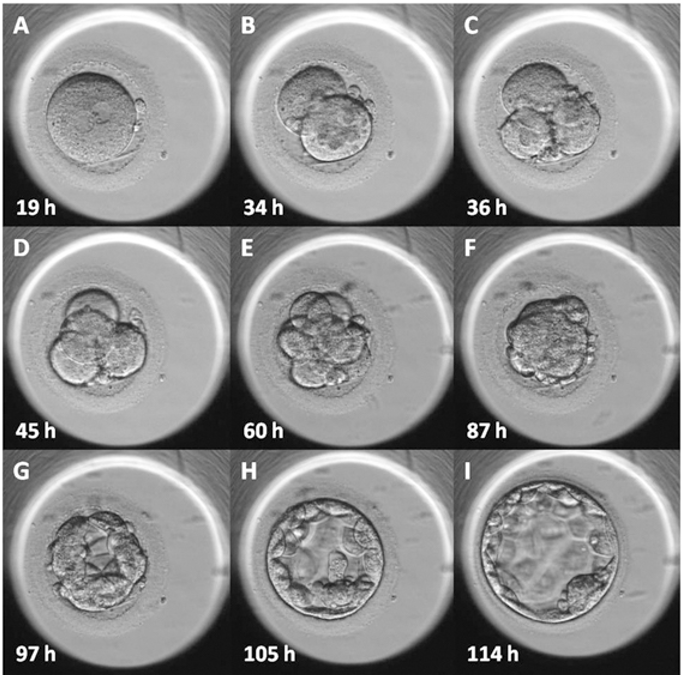 Time Lapse Εμβρύου | IVF REA